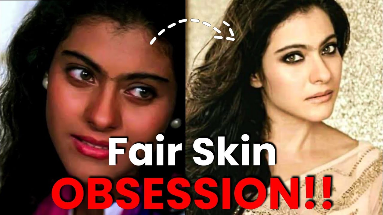 Why are Indians Obsessed with Fair Skin? - YouTube
