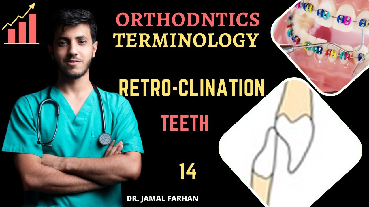 ORTHODONTIC | Lecture 1 | Part 14 | Retro clination teeth | كورس تقويم ...