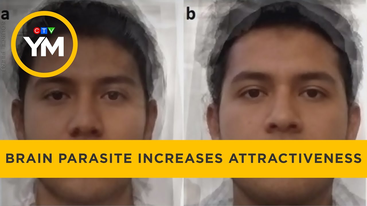 Brain parasite makes people appear more attractive | Your Morning - YouTube