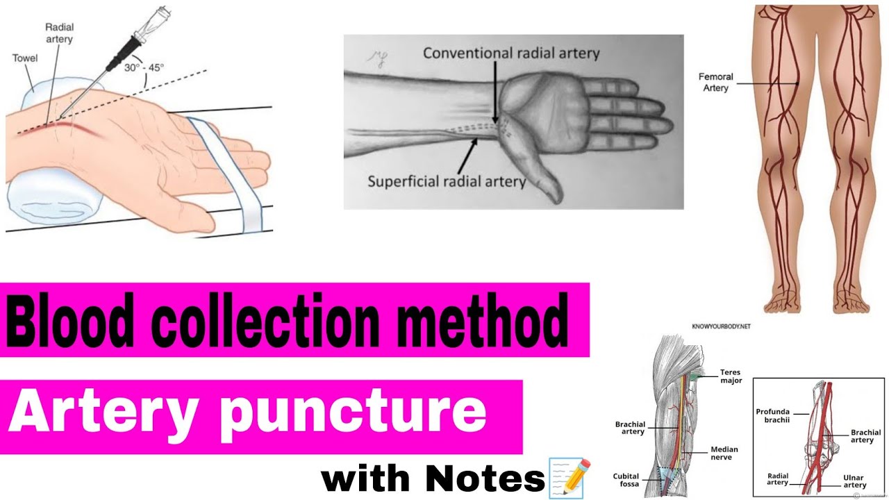 Artery blood collection | blood collection by Artery | Artery ...