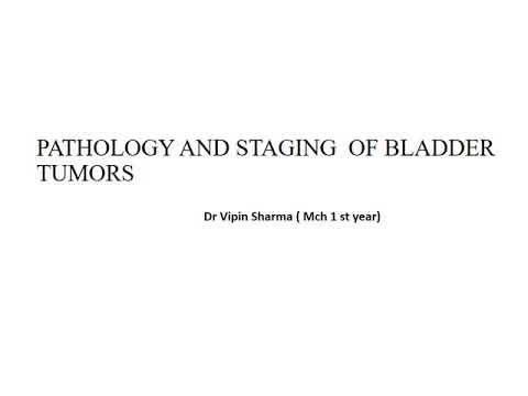 CA urinary bladder stage and basic pathology - YouTube