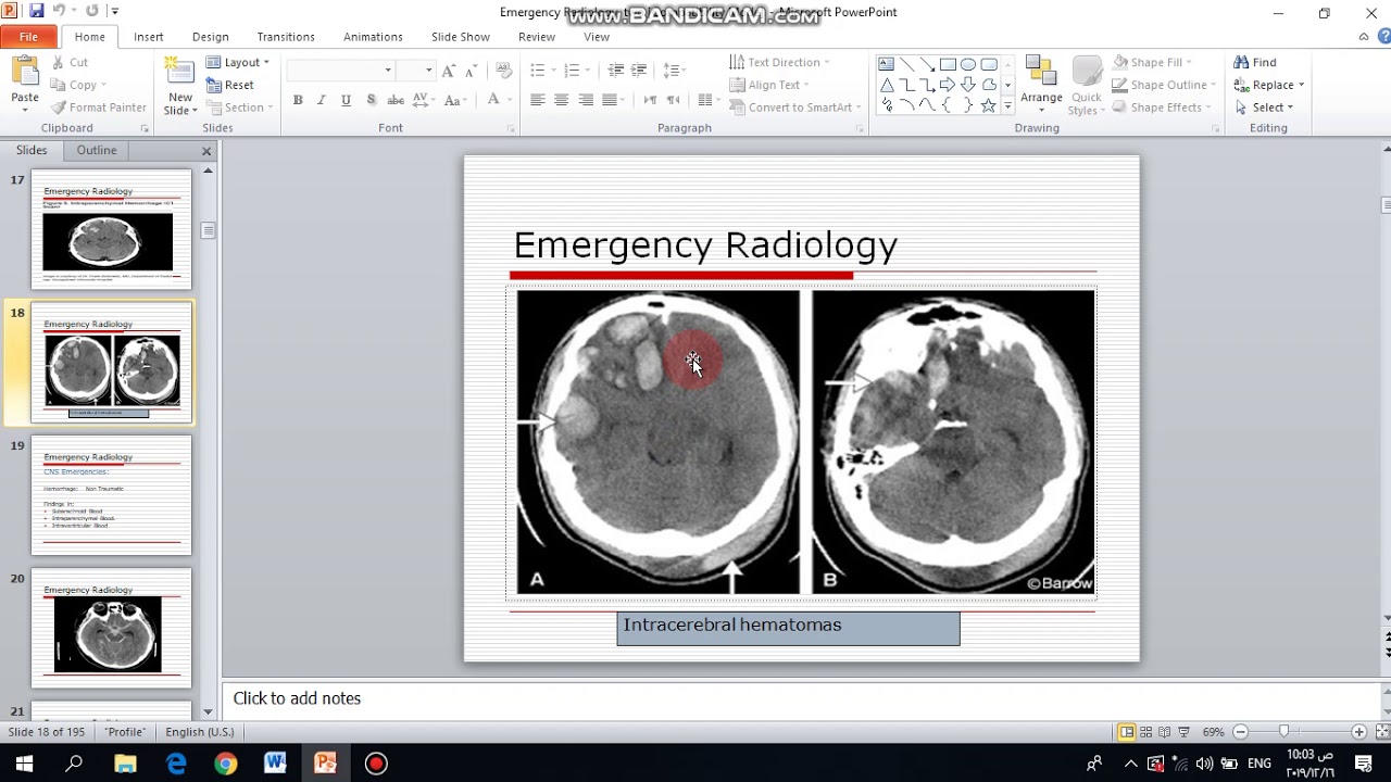 EMERGENCY RADIOLOGY PART 3 - YouTube