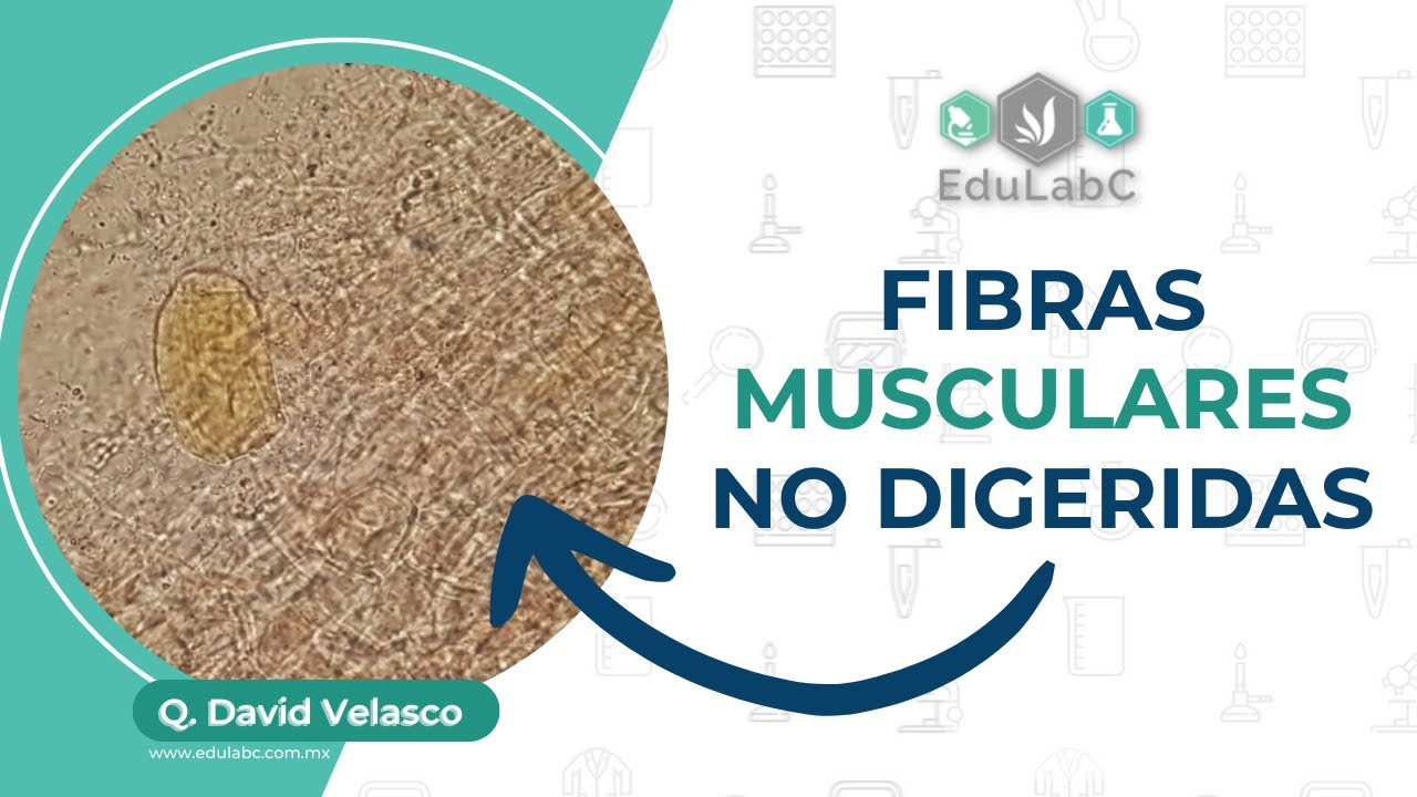 🔬 Laboratorio Clínico: Fibras musculares no digeridas - YouTube