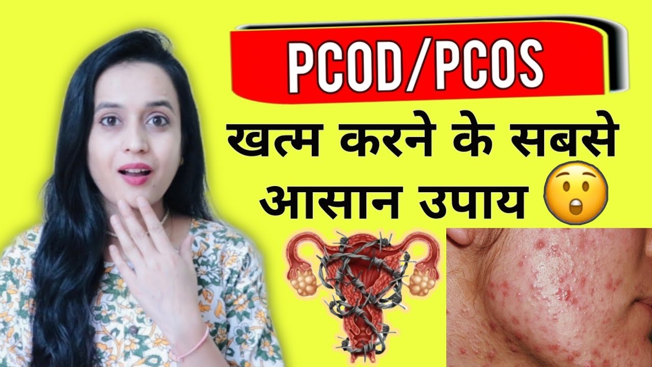 PCOD/ PCOS Solution ACNE CURE | Everything You Need..😻How to Cure ...