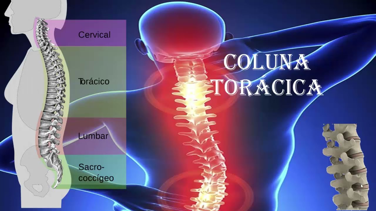 POSICIONAMENTO RADIOLÓGICO | COLUNA TORÁCICA AP - YouTube
