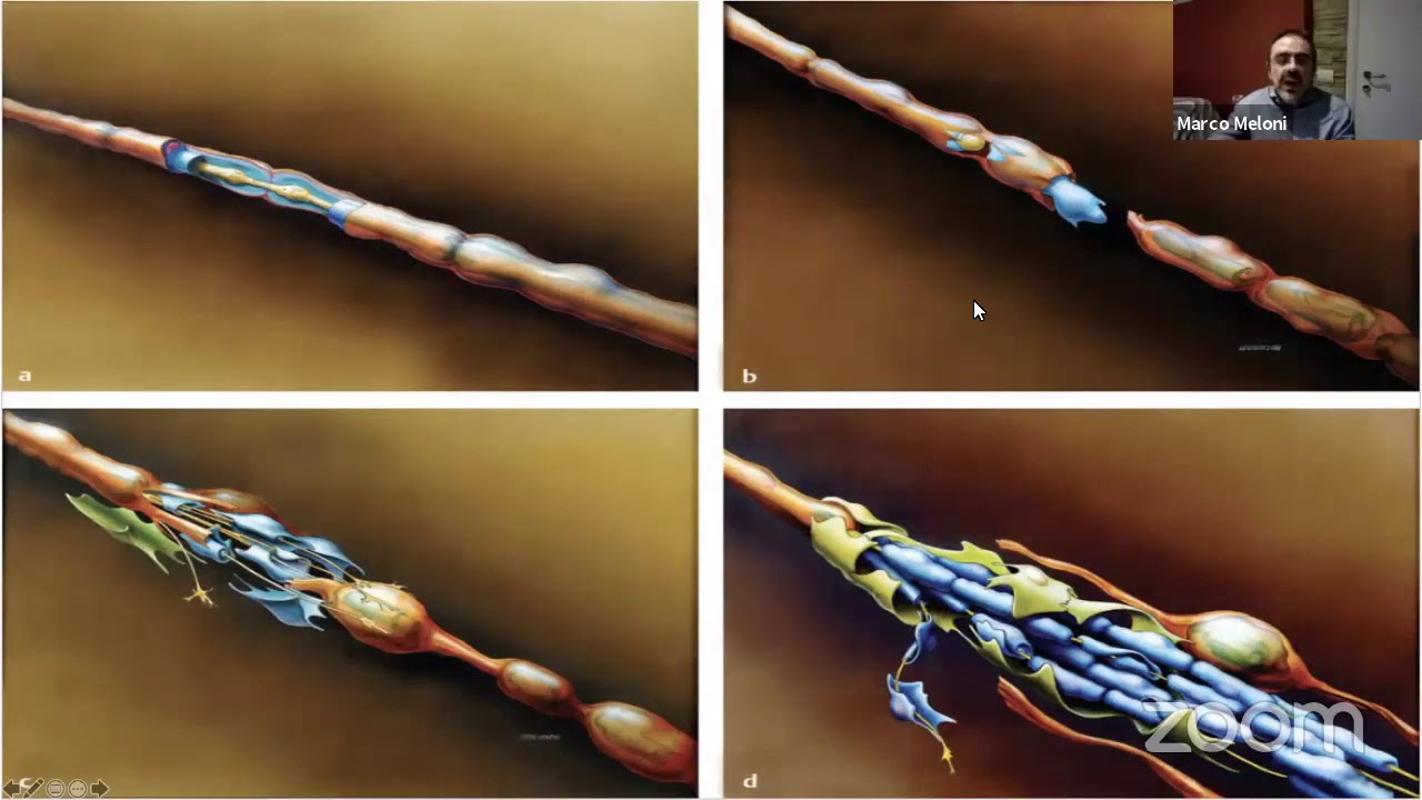 Peripheral Nerve Surgery: Basic Principles - YouTube