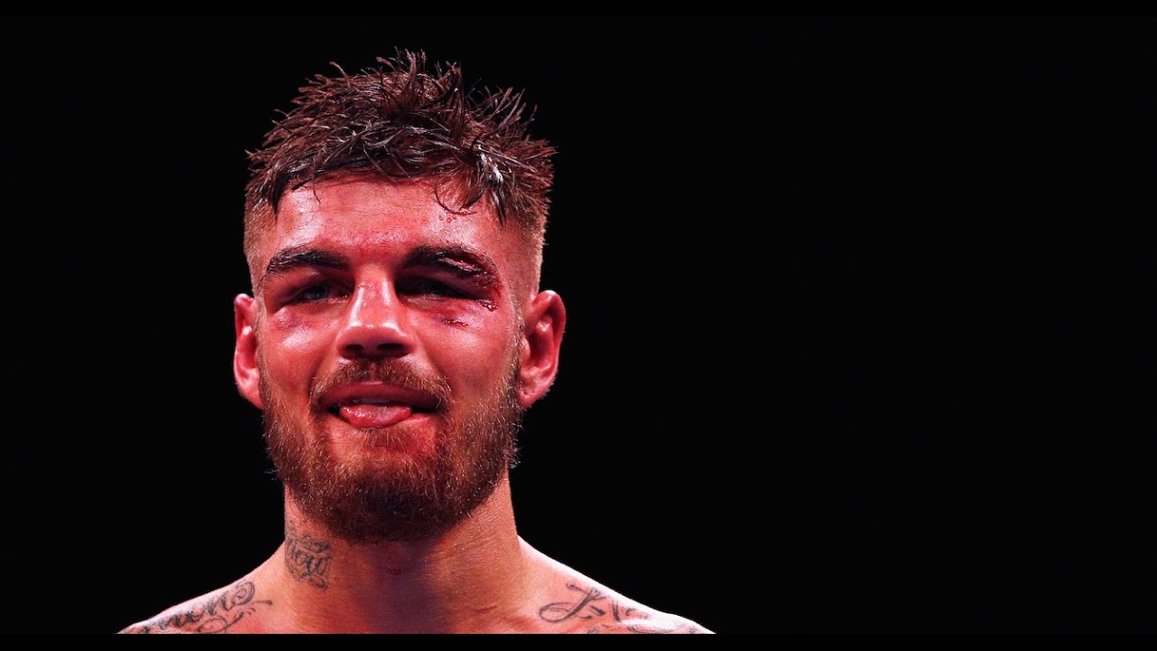 The Medical Dangers of Boxing - YouTube