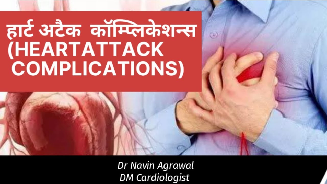 The Risks and Impacts of Heart Attack Complications" - YouTube