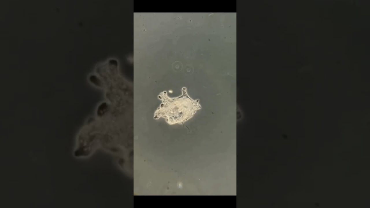 Amoeba || phagocytosis ||How amoeba engulf food|| Pseudopodia || - YouTube