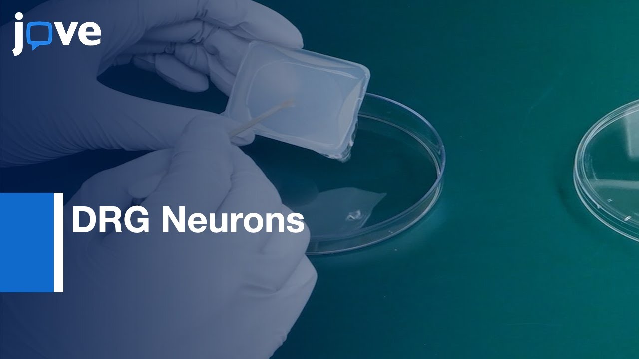Alignment and Myelination of DRG Neurons | Protocol Preview - YouTube