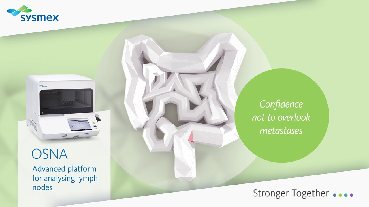 Oncology OSNA 1080p - YouTube