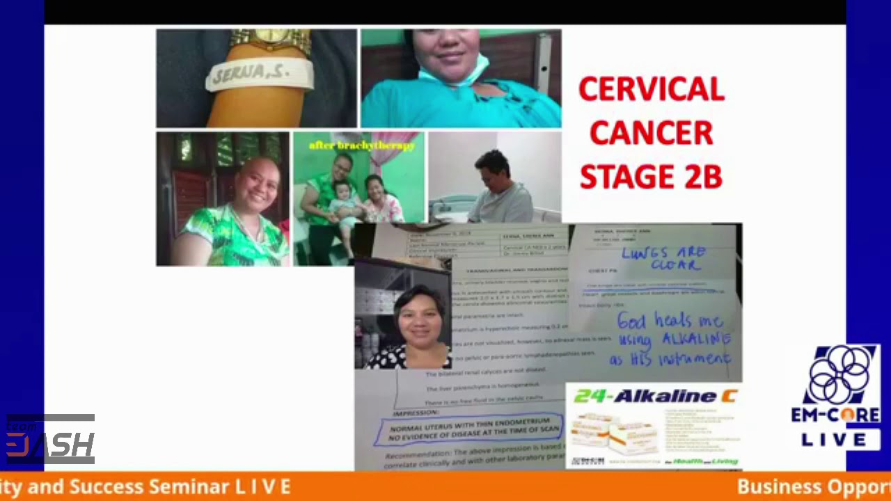 Cervical Cancer Stage 2B - 24 Alkaline C | Team Dash - YouTube
