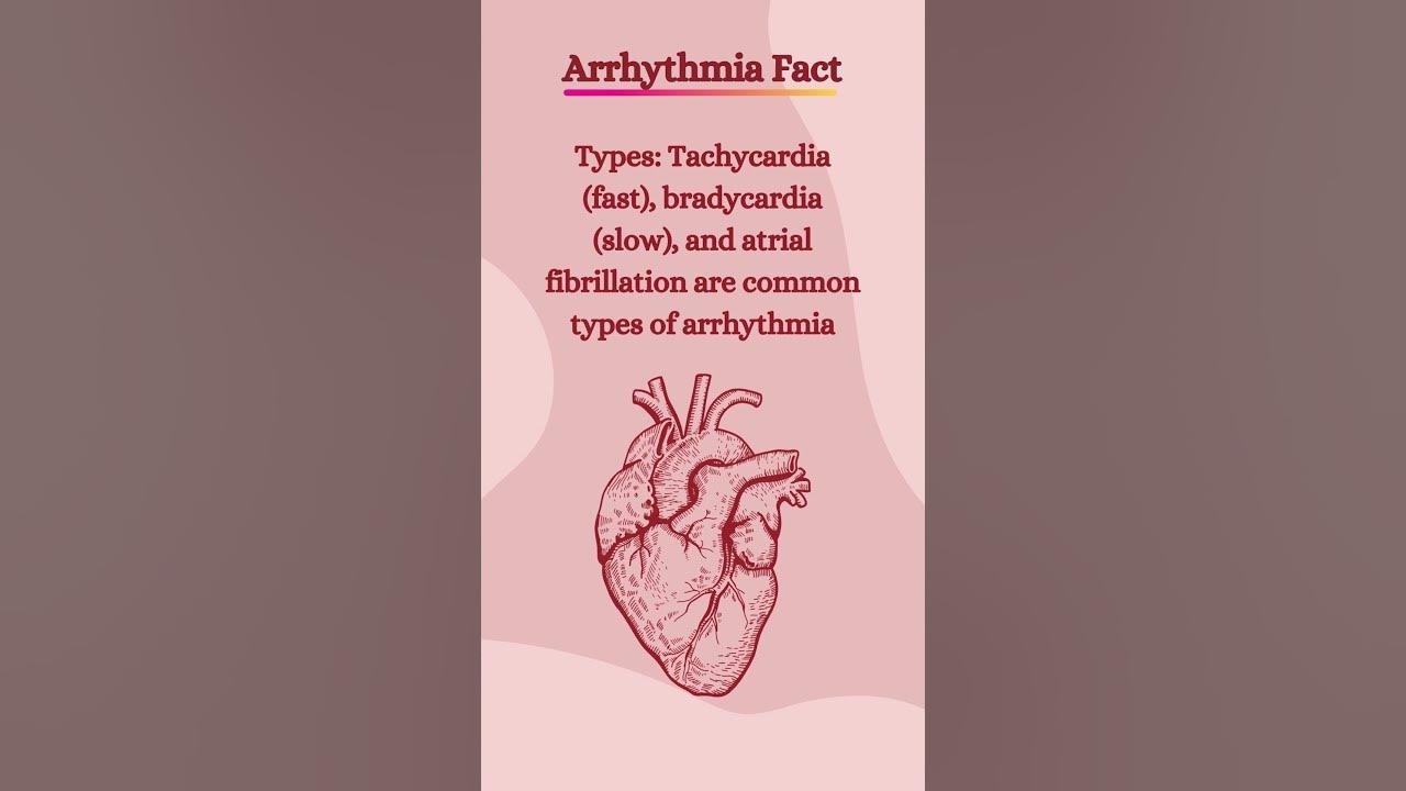 Understanding Arrhythmia Types and Management #shorts - YouTube
