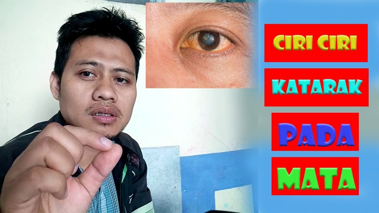 Ciri Ciri Katarak Pada Mata - YouTube