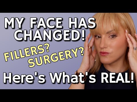 What I’ve Actually Had Done to My Face (Full Transparency)