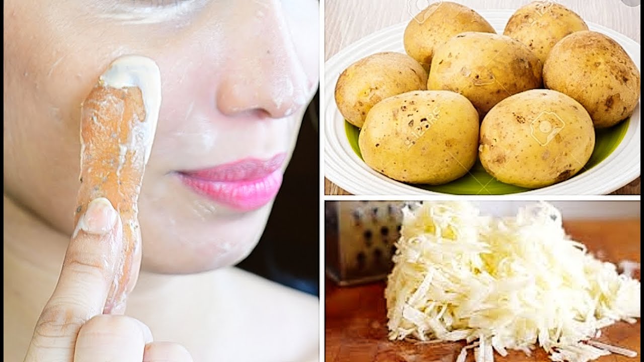 i Rub Potato Peel Every Night & Removed Dark Spots in Just 5 Days ...