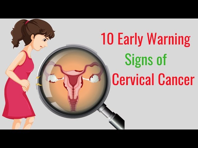 10 Early Warning Signs Of Cervical Cancer You Should Not Ignore