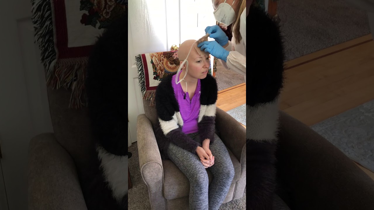 Getting fitted for my Optune Cap - YouTube