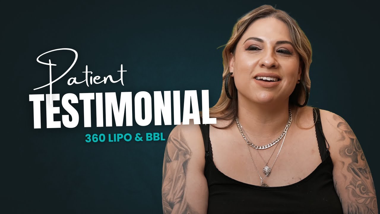Patient Testimonial, 360 Liposuction with Brazilian Butt Lift (BBL ...