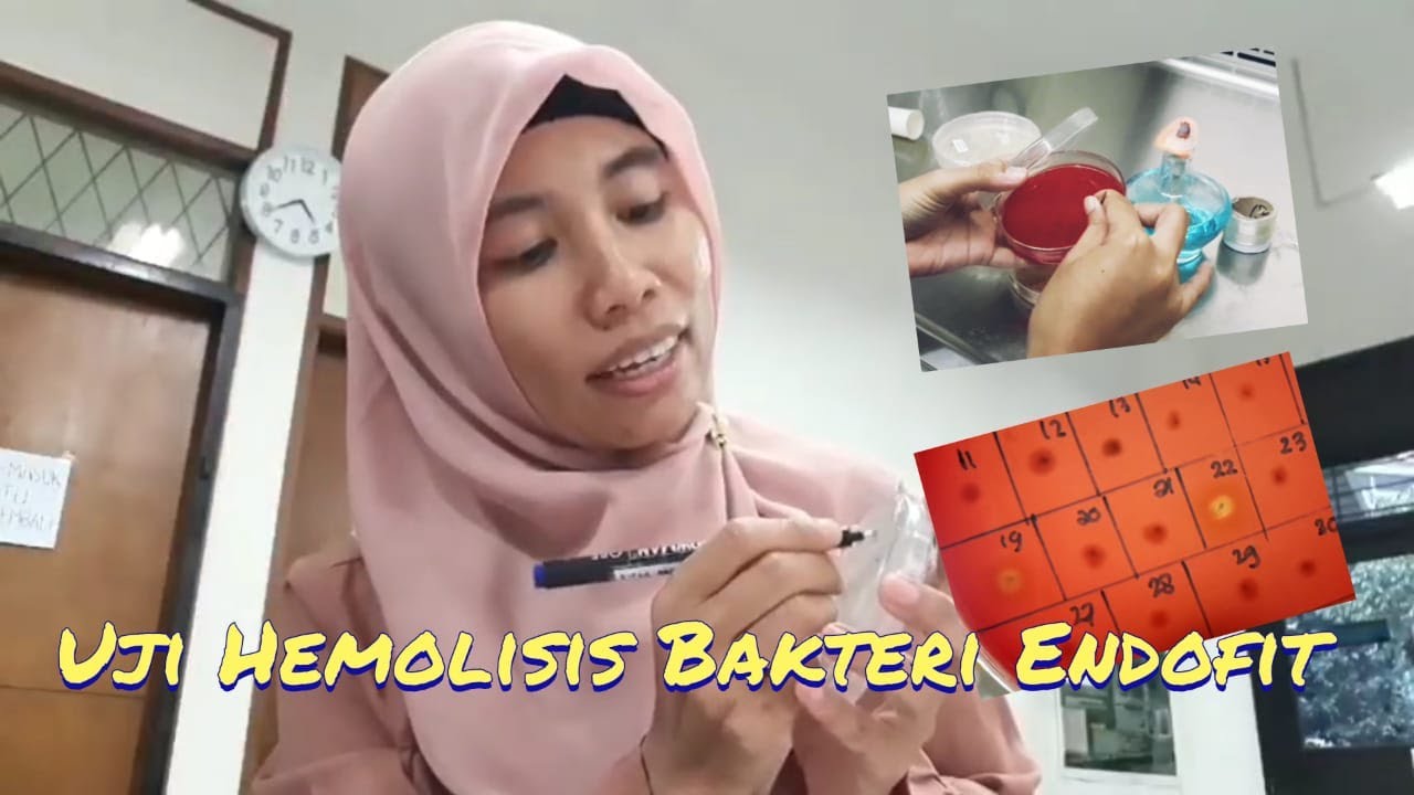 Uji Hemolisis (Bakteri endofit Tahap 3) - YouTube