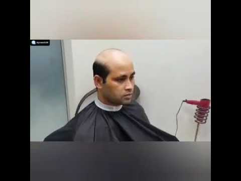 Hair wik hair patches in Bhilwara