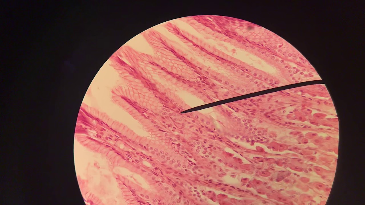 Stomach slide 400X - YouTube