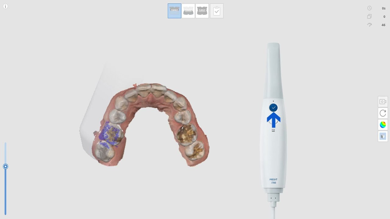 2-3. Scan Strategy_Maxilla (ENG) - YouTube