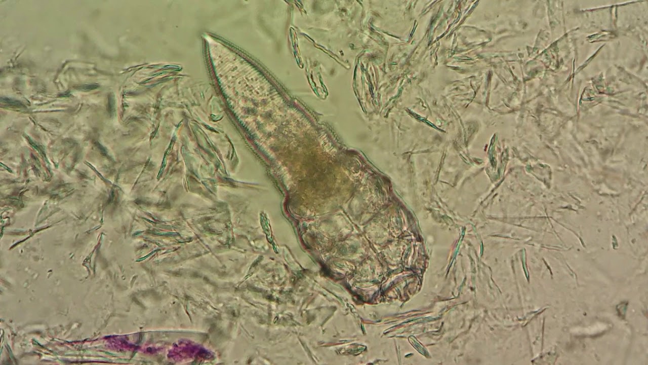 DEMODEX.모낭충.모낭충현미경.DEMODEX MICROSCOPE. - YouTube