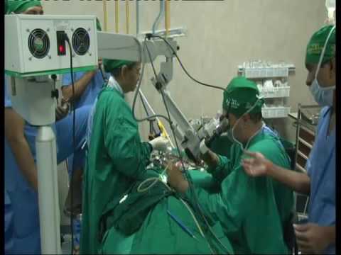 Stapes surgery /Obliterative Foot Plate UNEDITED ( Case 8 ) - Dr.Ashim ...