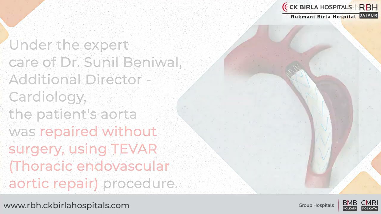RBH (Rukmani Birla Hospital) | Patient testimonial | TEVAR Procedure ...