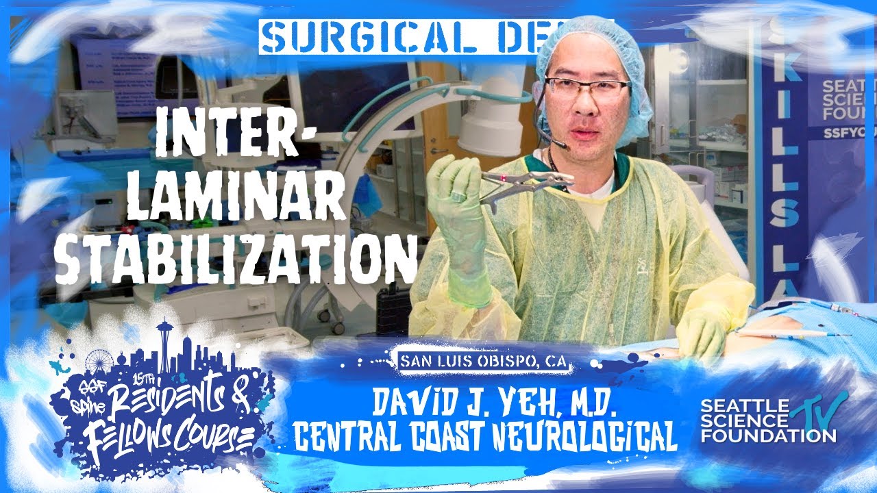 Surgical Demo: Interlaminar Stabilization - David Yeh, M.D. - YouTube