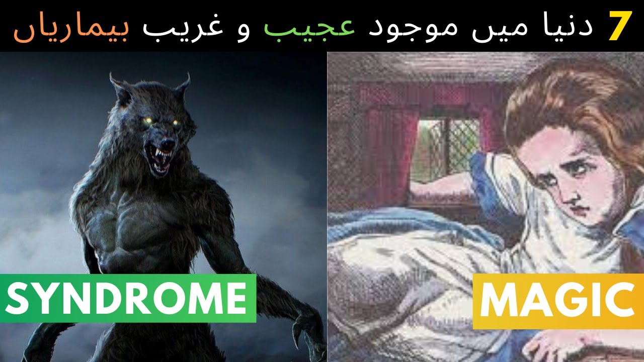 The 7 Most Weird Diseases In The World - YouTube