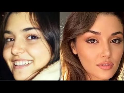 Hande Ercelin Makyajsiz Hali Sosiyal Medyada Olaya Sebeb Oldu!