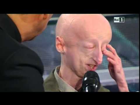 Sanremo 2015 - Sammy Basso - Quarta serata 13/02/2015 - YouTube