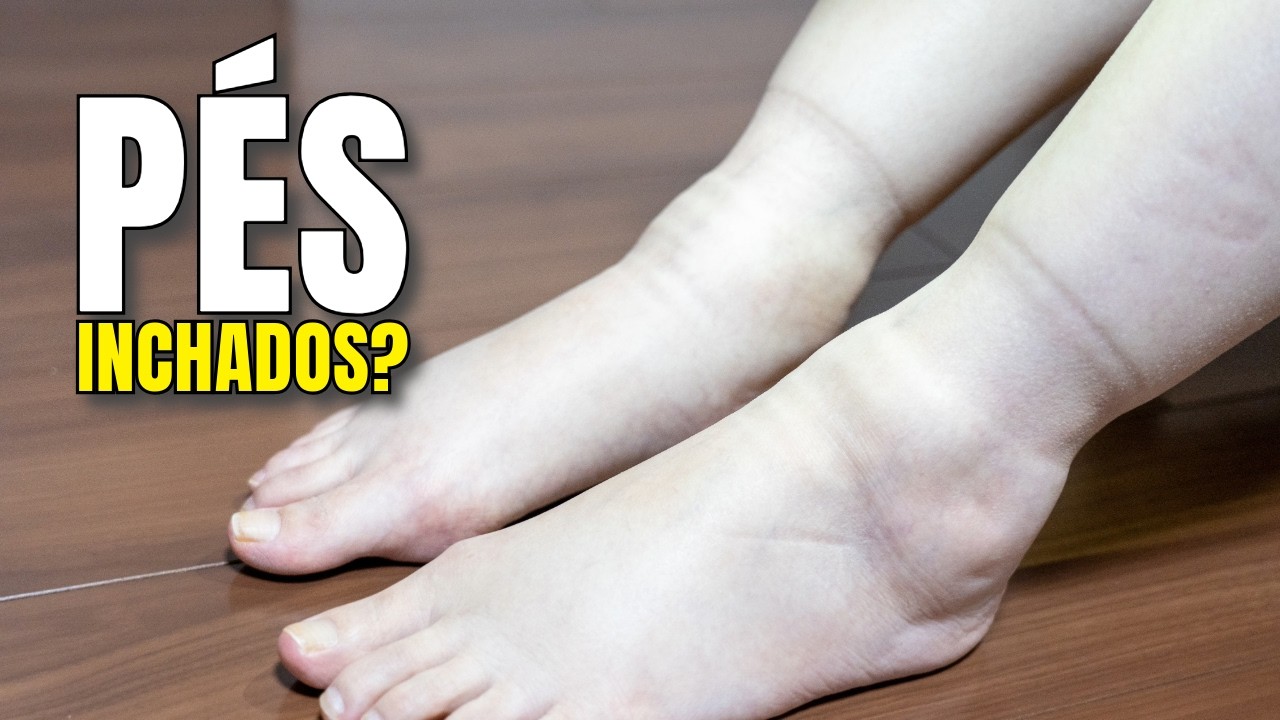 5 Coisas que Você Não Sabia sobre Inchaço nos Pés - YouTube