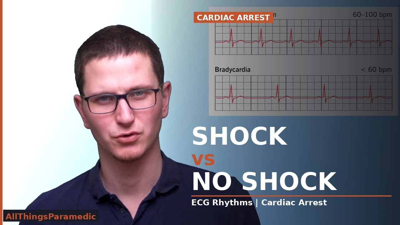 Shockable vs Non Shockable ECG Rhythms Clear Guide for Cardiac Arrest ...