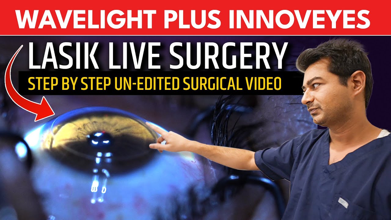 Step-by-Step WaveLight Plus InnovEyes LASIK Live Surgery - YouTube
