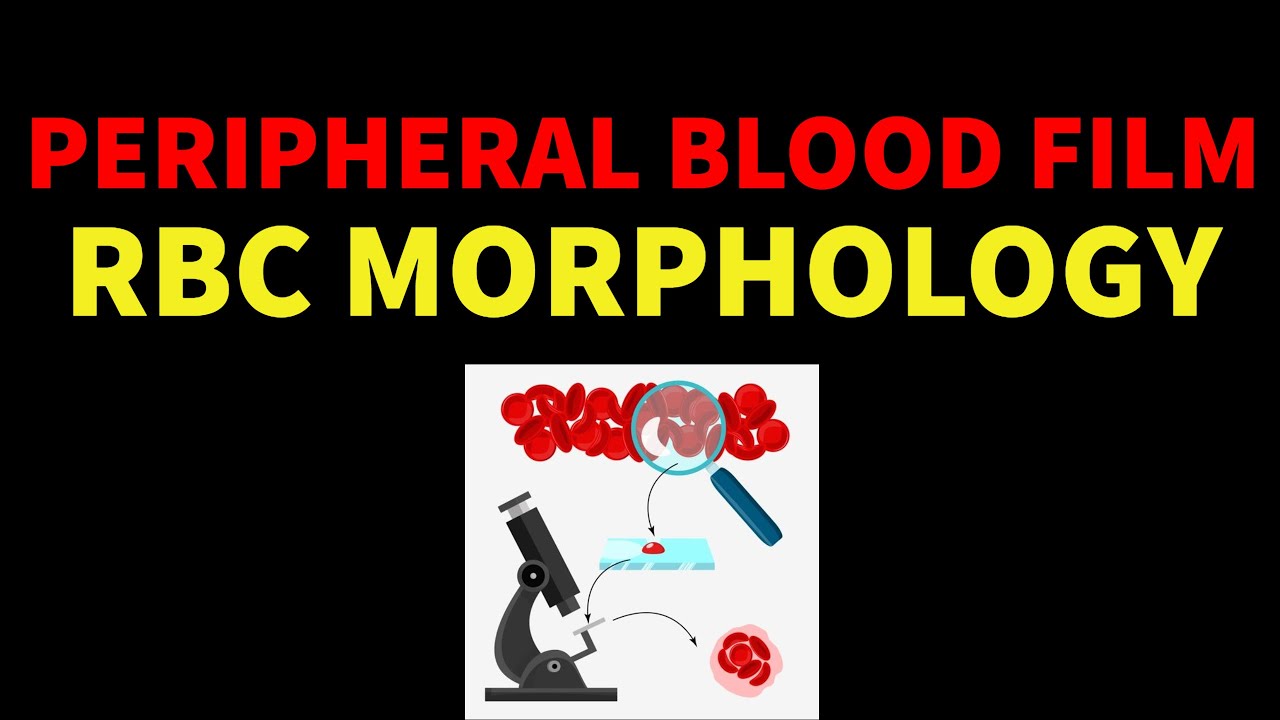 PBF - RED BLOOD CELL MORPHOLOGY - PART 1 | Dr.Sonu Yadav | Pathology ...