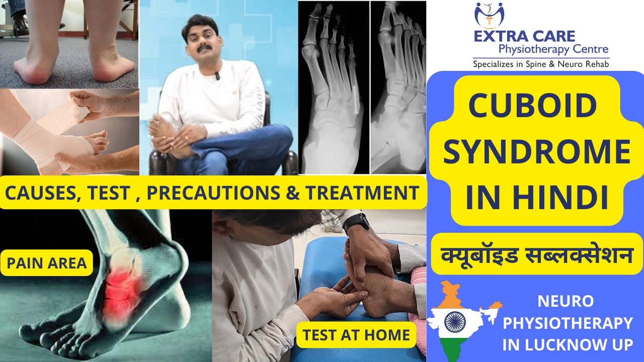 Cuboid Syndrome in Hindi | Lateral Foot pain, Causes, Signs and ...