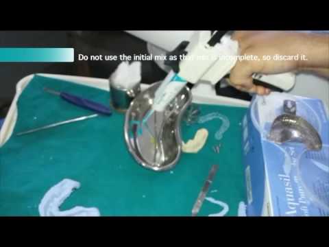 Implant Impression using closed tray technique - YouTube