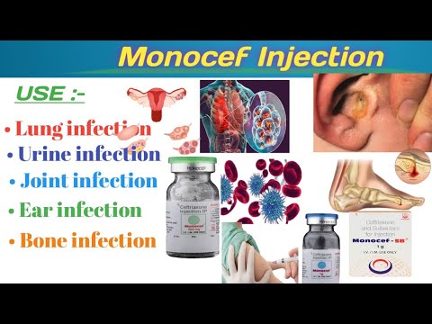 Monocef Injection || Mechanism || Antibiotics ||Side effects || Medical ...