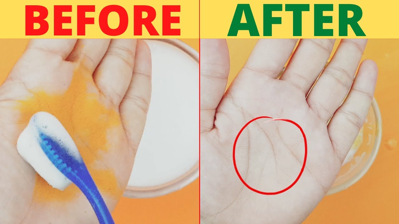 Quick Remove Yellow Turmeric Stains from Skin & Nails | 5-Minute Bright ...