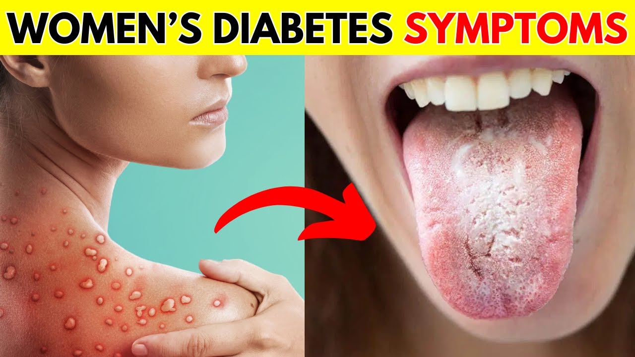 8 Deadly Diabetes Signs in Women You Shouldn't Ignore! - YouTube