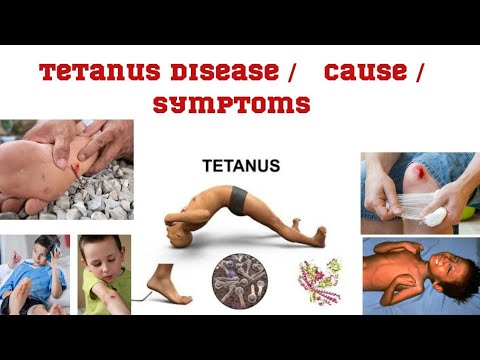 Tetanus Disease Cause || Symptoms & Treatment || Prevention ...