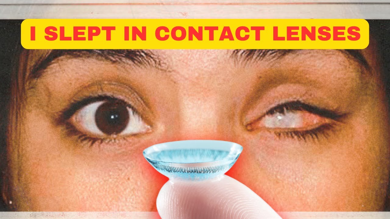 The Terrifying Risks of Sleeping In Contact Lenses - YouTube