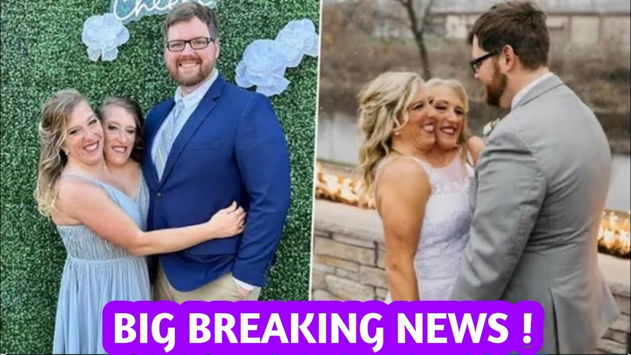 Can Conjoined Twins Give Birth? - YouTube