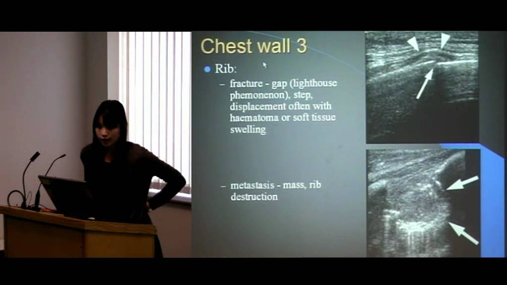 Chest Ultrasound Anatomy & Pathology - YouTube