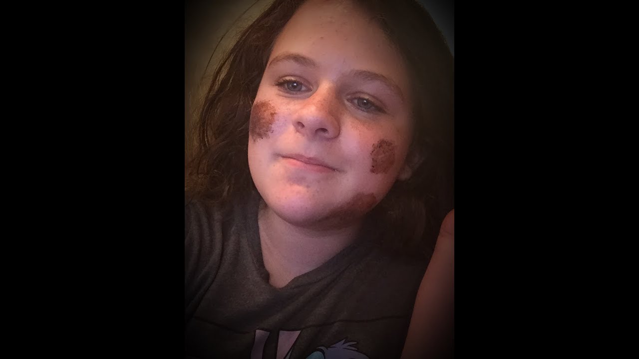 Makeup Tutorial : Realistic Injury - YouTube