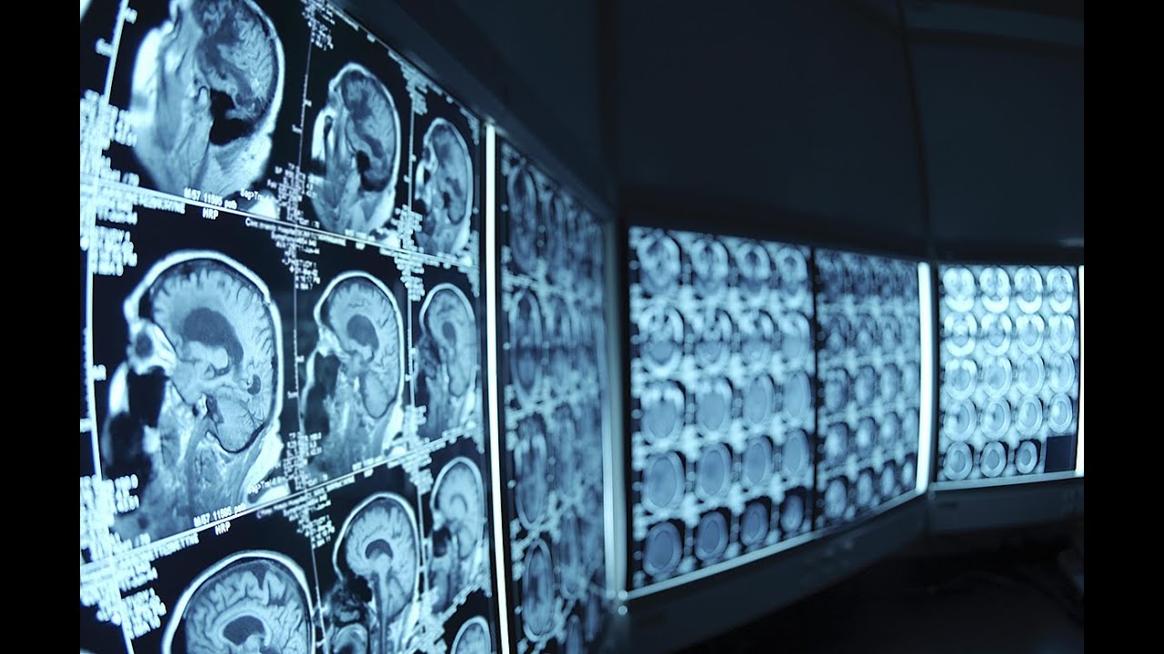 To Radiology with Love - Introduction to imaging - YouTube