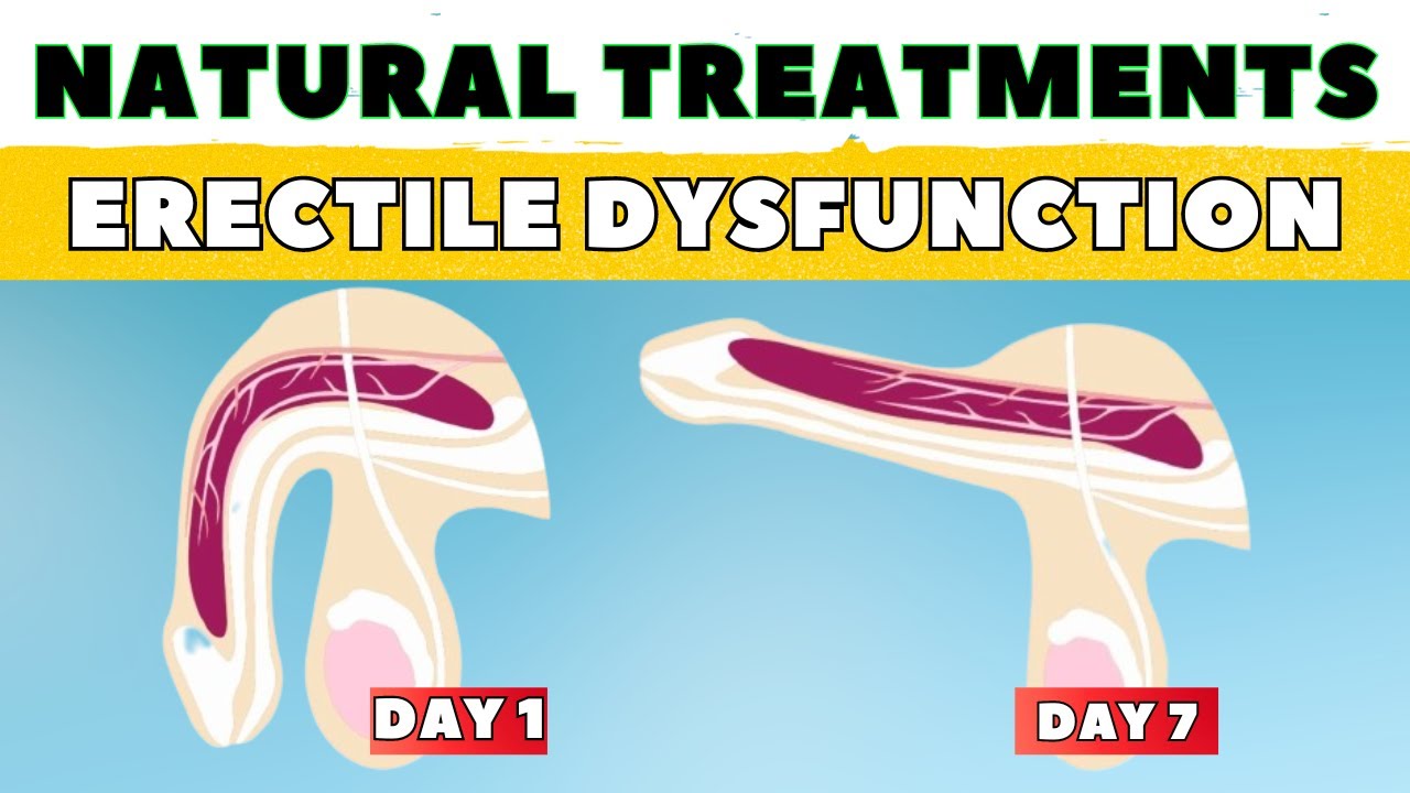 Top 6 Ways To Overcome Erectile Dysfunction Naturally No Pills Youtube